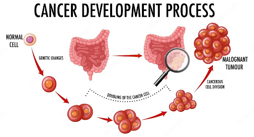 IISc Develops Novel Approach To Detect, Kill Cancer Cells